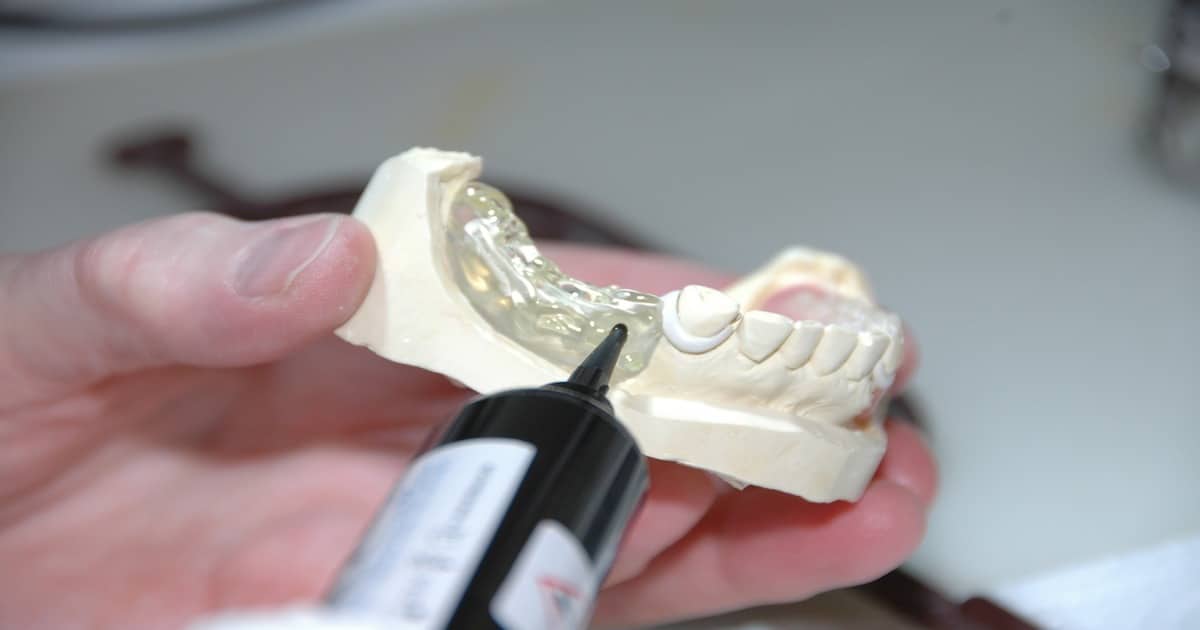 Prótese Parcial Removível Tem Custo Menor que Implantes