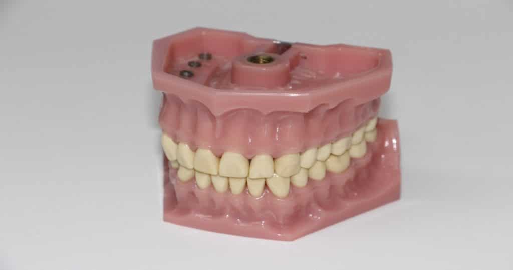 Tudo Sobre o Periodonto e suas Principais Estruturas
