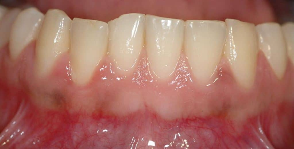 Tudo Sobre o Periodonto e suas Principais Estruturas